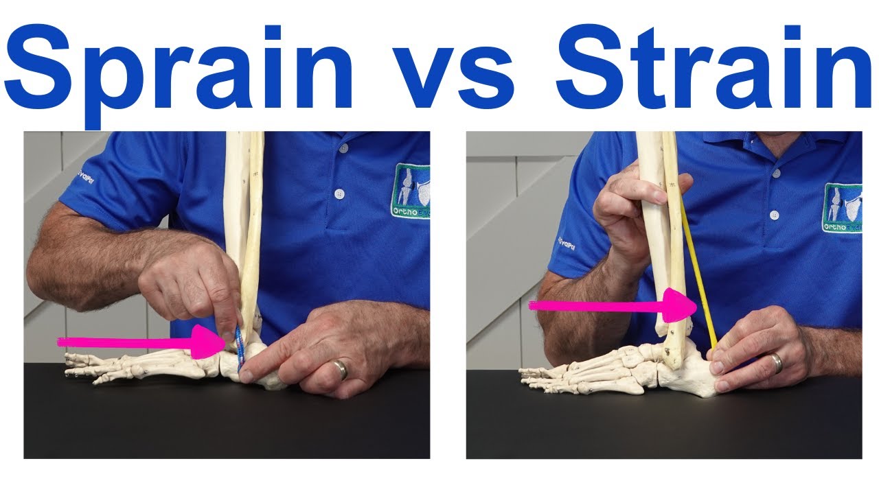 Sprain vs Strain: Understanding the Key Differences