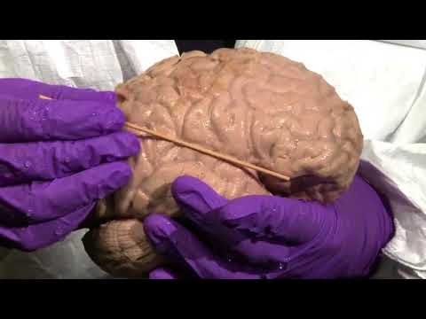Finding the Central Sulcus