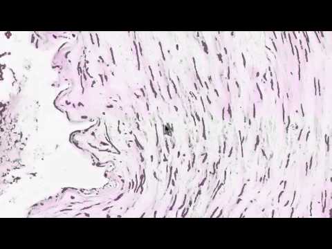 vasculature2.m4v