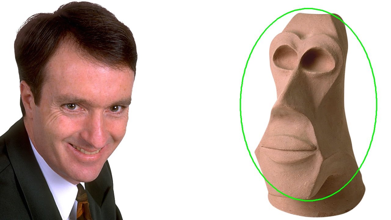 figure-shape ASL