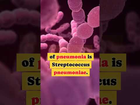 Most common cause of bacterial pneumonia #pneumonia #lunginfection #bacterial #usmle #medstudent