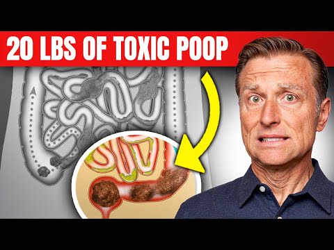 Do We REALLY Have 5 to 20 lbs of Toxic Poop in Our Colons?