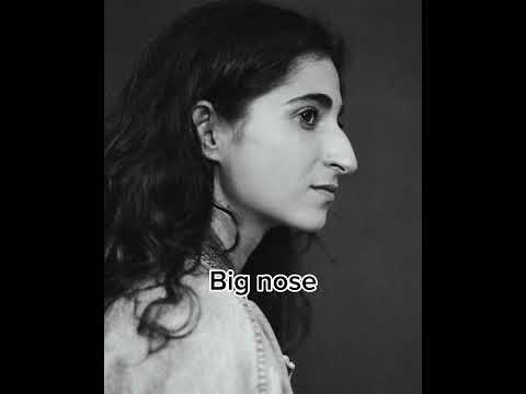 Big nose: Ugly facial features that is actually attractive