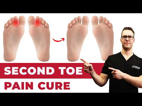 What Causes Toes to Curl Up? | 3 Causes & Best Treatment