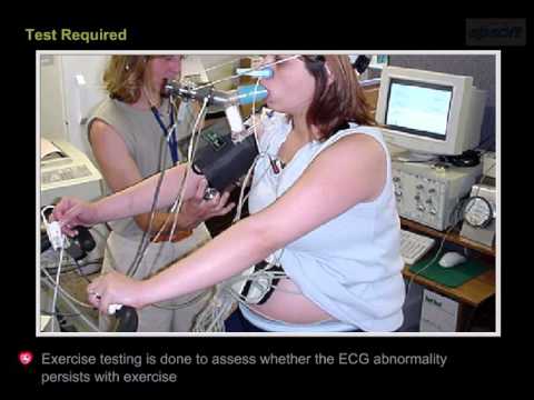 Tests Required for Parkinsons disease