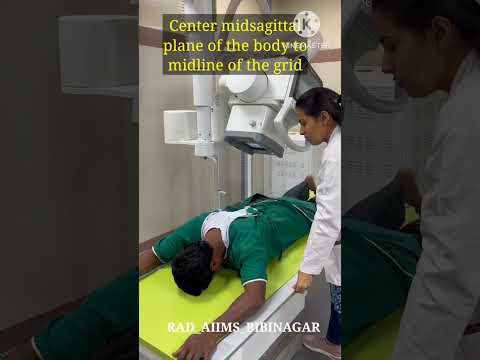 How to take Radiograph of Cranium PA Axial ( HAAS Method ) #hospital #radiology #cranium