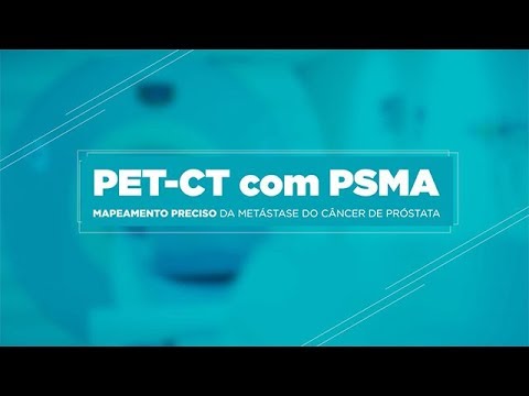 PET-CT PSMA: melhor diagnóstico de casos de câncer de próstata
