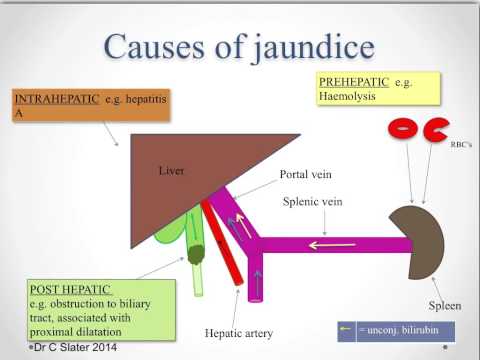 The liver, jaundice and portal hypertension