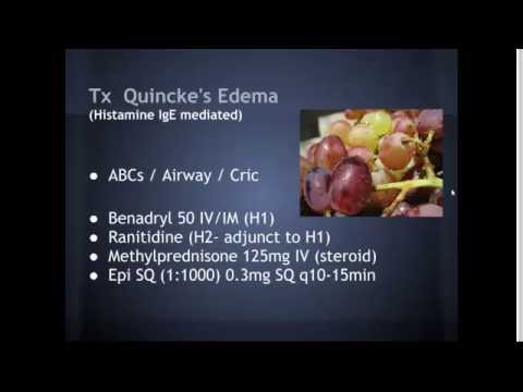 Quincke’s Edema – EM in 5
