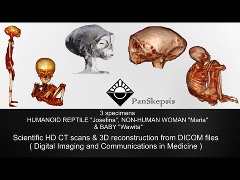 Nazca Alien Mummies - HD CT Scans of Josefina (Humanoid Reptile), Maria (Jamin Palpanensis) & Wawita