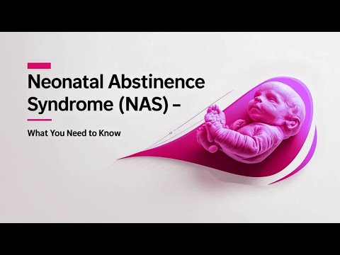 Recognizing And Helping Babies With Neonatal Abstinence Syndrome