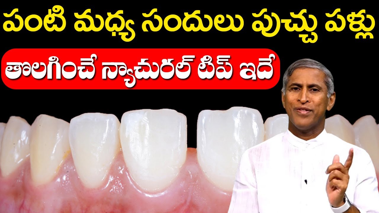 Natural Tips To Close Gaps Between Teeth Insights From Dr Manthena