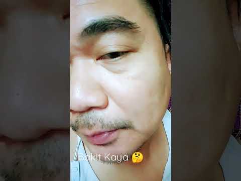 BAKIT KAYA NAKURAP KURAP MATA KO