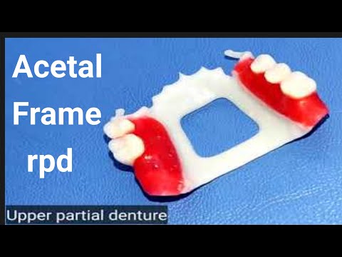 Milled acetal partials. Acetal rpd