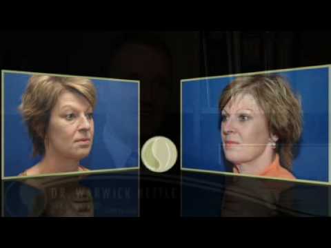 Dr Nettle Of Silkwood Medical Talks About Blepharoplasty (Eyelid Surgery)