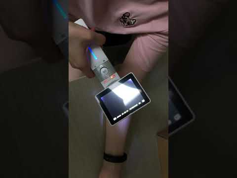 Digital Dermatoscope