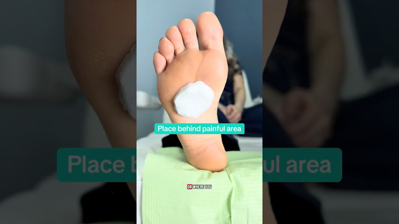 Metatarsal Pad #footpain #footpainrelief #padding #podiatry #doctor