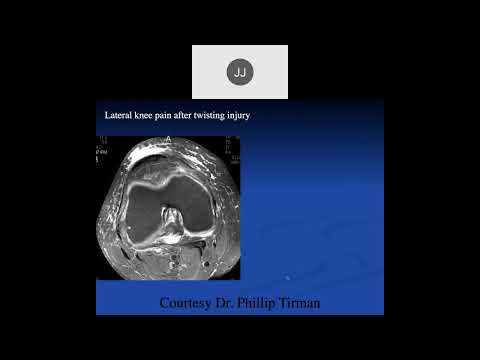 MRI of the Knee Tendons & Extensor Mechanism | Part 1, 2023