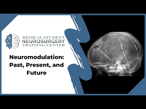 Neuromodulation: Past, Present, and Future
