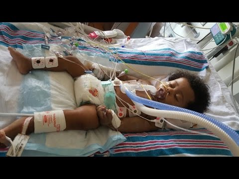 Congenital Vascular Malformation: Baby fights rare disease that's hard to diagnose, treat