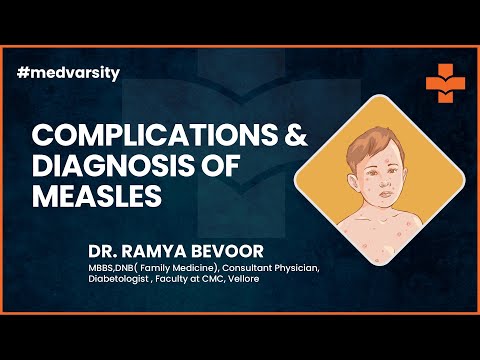 Complications & Diagnosis of Measles | Medvarsity