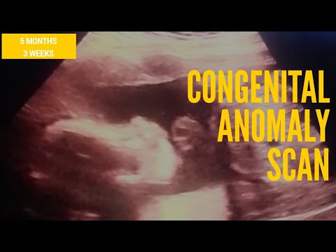 What Happens During A Congenital Anomaly Scan (at 23 Weeks) | Pregnancy