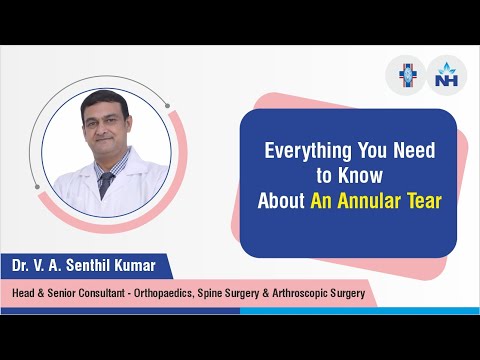 Treatment of Annular Tears | Dr. V.A. Senthil Kumar