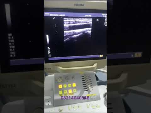 Toshiba Ultrasound Machines - Toshiba USG Machine Latest Price, Dealers ...