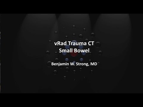 Small Bowel | 10-minute Radiology Case Reviews