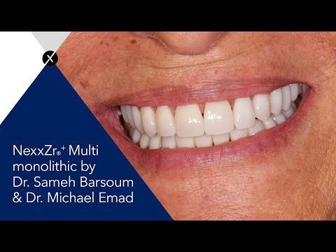 Sagemax experience: NexxZr+ Multi monolithic by Dr. Sameh Barsoum & Dr. Michael Emad
