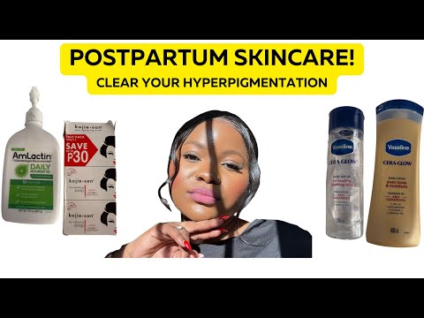 DEALING WITH HYPERPIGMENTATION| AMLACTIN LOTION REVIEW| VASELINE CERAGLOW?| KOJIC ACID SOAP