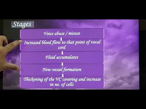Vocal cord nodule Part 1 (Urdu) Patient teaching programme
