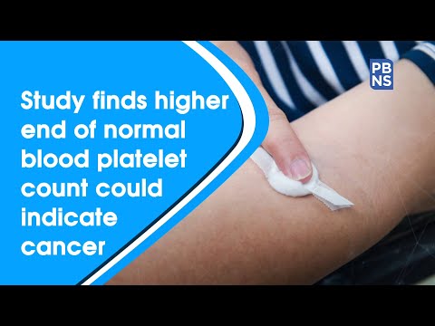 Study finds higher end of normal blood platelet count could indicate cancer