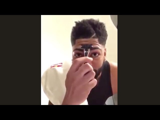 Anthony Davis' unibrow has been a part of his iconic appearance, but ...