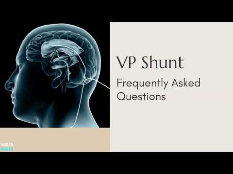 VP Shunt- Frequently Asked Questions