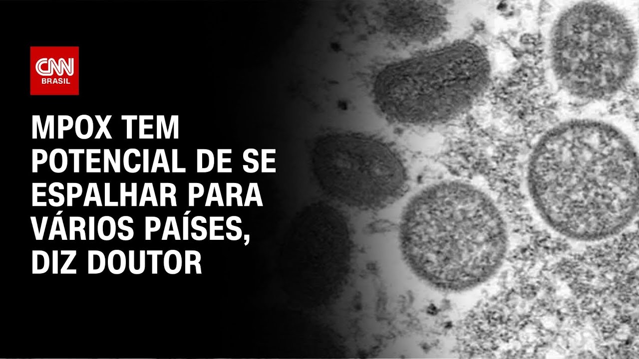 Estado de São Paulo registrou 315 casos de mpox de janeiro a julho ...