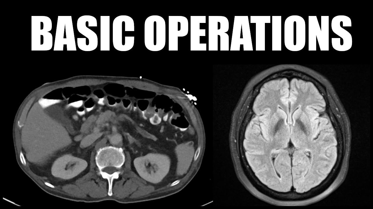 FireVoxel Tutorial 1: Basic Operations