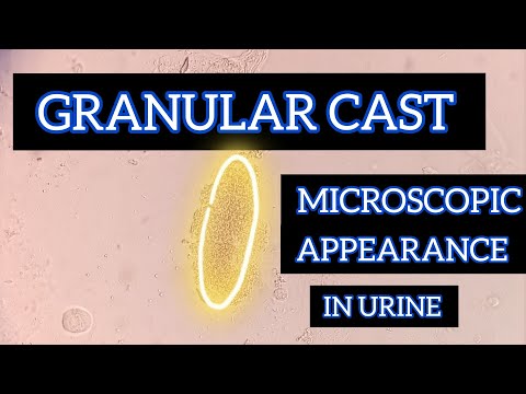 Granular Cast in Urine | Microscopic Appearance | Short Video | @PathologyMaster7044