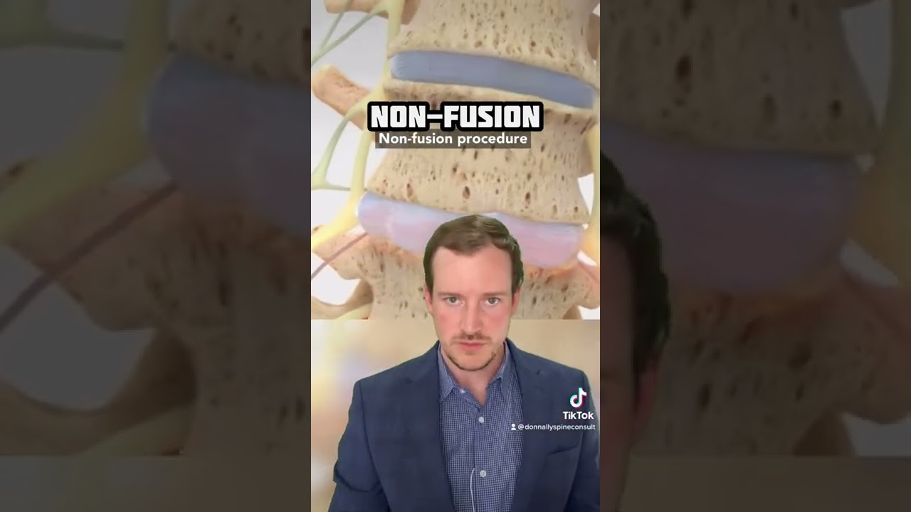 #1 Disc Replacement (spine doctor explains) 👍