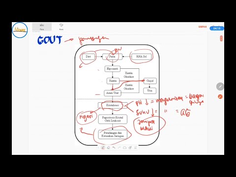 Patofisiologi Asam Urat (Arthritis Gout)