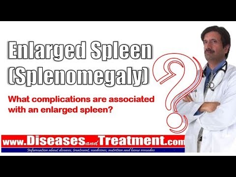 Enlarged Spleen (Splenomegaly): What complications are associated with an enlarged spleen?