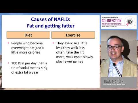 NAFLD: diagnostics, management and screening | Juan Macías, MD, PhD