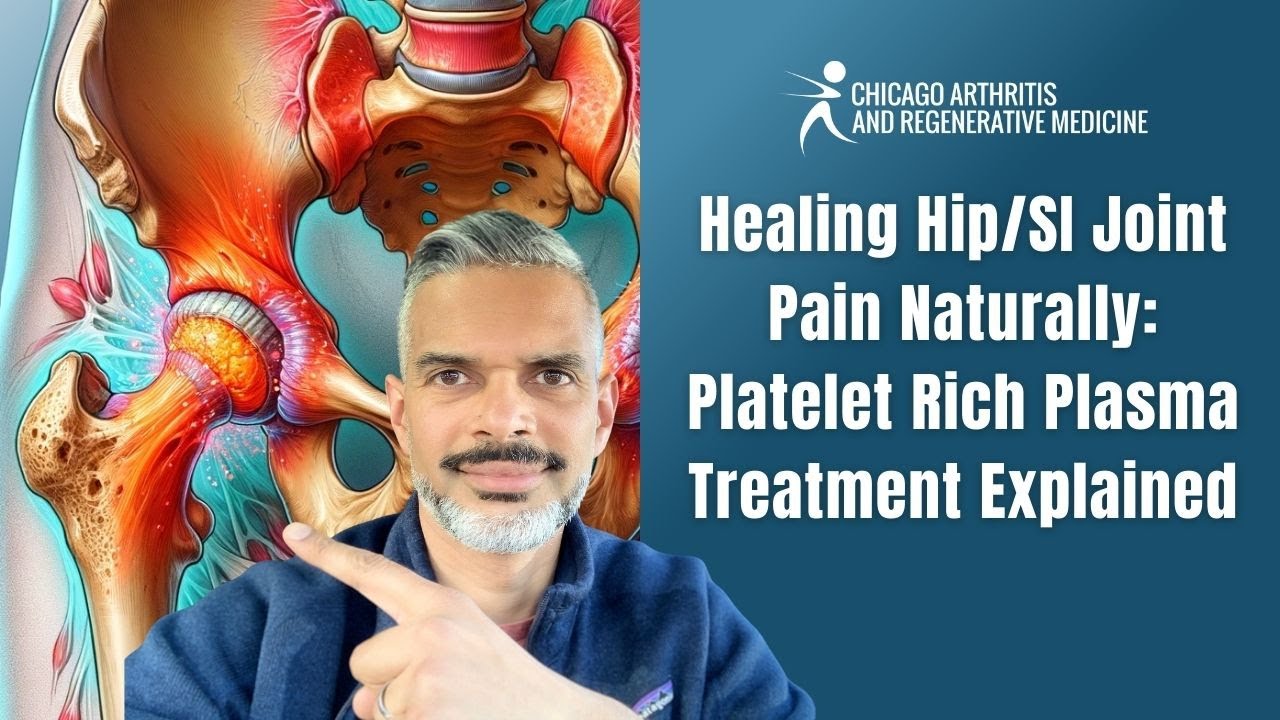 Platelet-Rich Plasma (PRP) for SI Joint and Hip Pain - Chicago ...