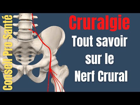 Cruralgie : Qu'est ce que le nerf crural / nerf fémoral ?