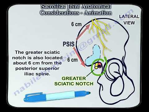 Sacroiliac Joint anatomy and its surrounding structures, a key to understanding low back pain