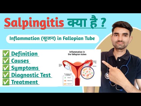 Salpingitis in Hindi | Causes, Symptoms And Treatment of Salpingitis