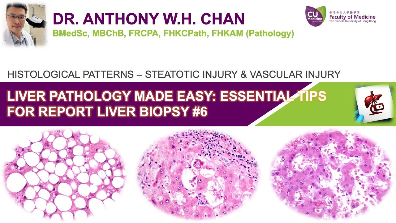 Liver Pathology Made Easy (6/7) - Essential Tips for Reporting Medical Liver Biopsy