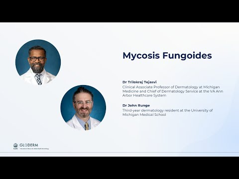 GTC Webinar Series 2025 | Mycosis Fungoides