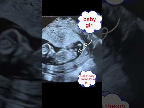 Baby girl | 12 weeks ultrasound |waving 👋 during scanning #pregnancy #baby #shorts