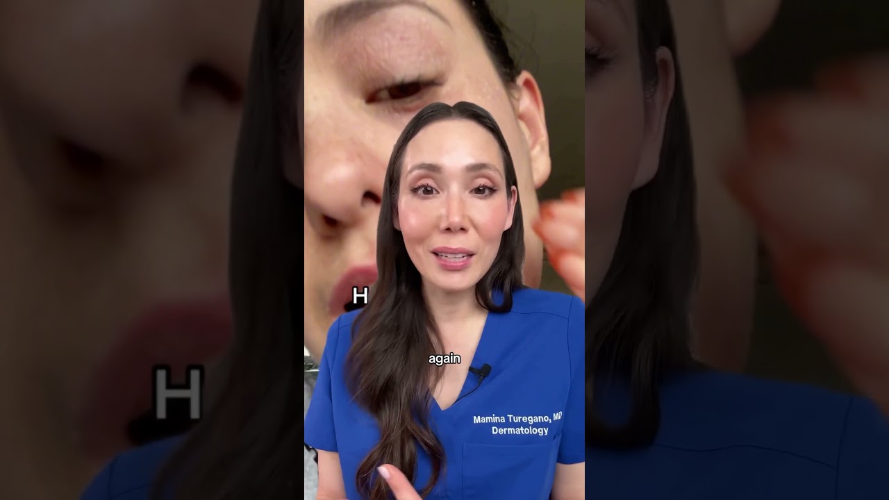 Eyelid Eczema: Part II